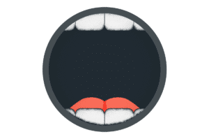 WAN Overlay and Underlay Projects blog | Cato Networks