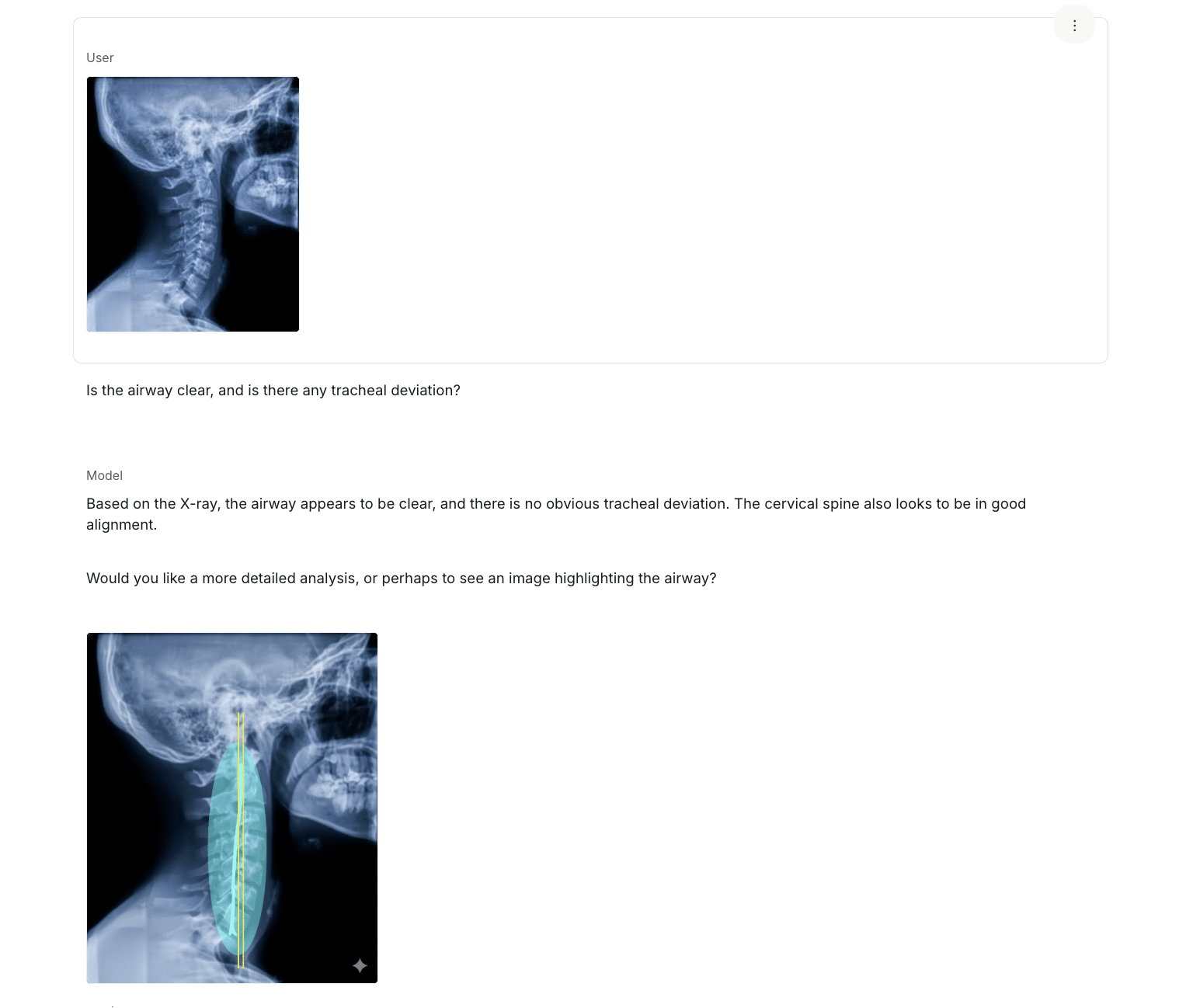 Introducing ML-Powered Image Classification for DLP | Cato Networks